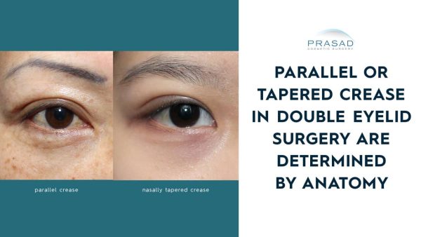 Facelift Surgery and Eyelid Surgery by Dr. Amiya Prasad, New York
